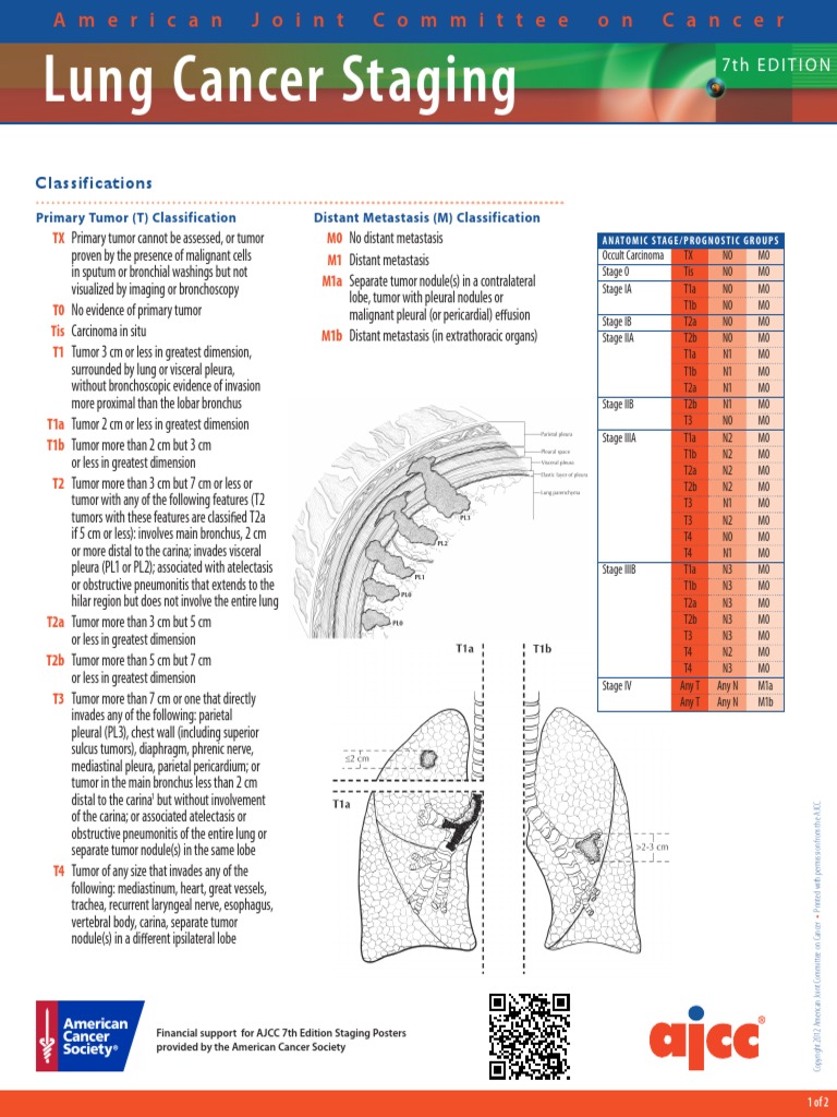 Lung Cancer Staging Poster Updated PDF | PDF
