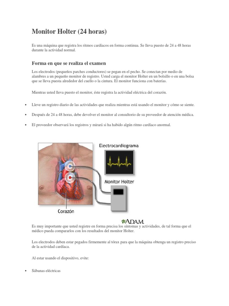 Monitor Holter | PDF | Medicina Interna | Fisiología Cardiovascular