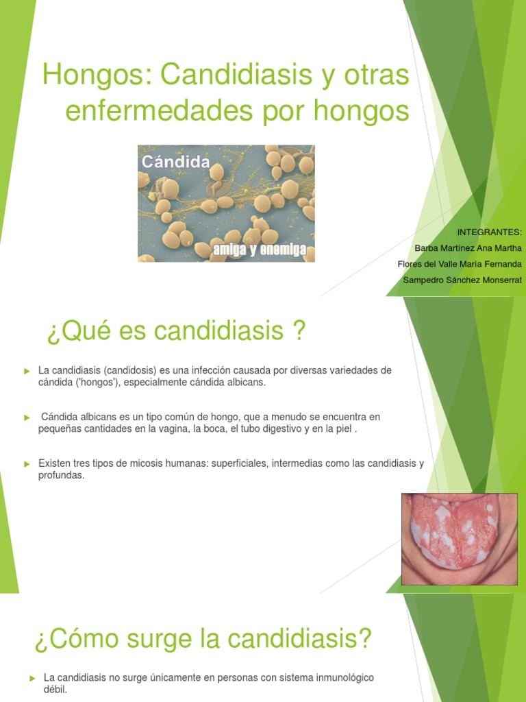 Candidiasis y Enfermedades Por Hongos en La Cavidad Bucal | Candidiasis ...