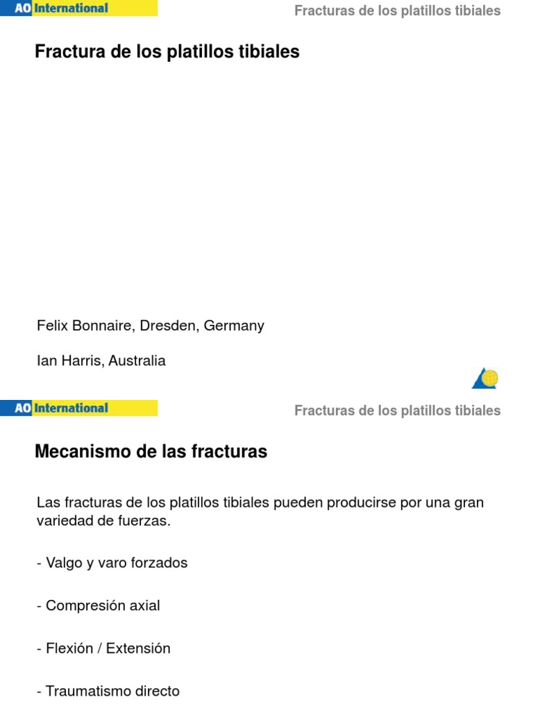 FX - Platillo Tibial | PDF | Lesión | Rodilla