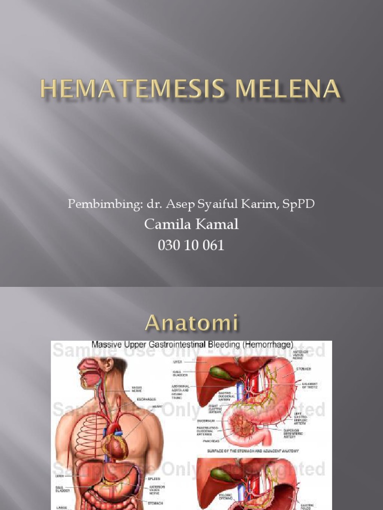 PPT Hematemesis Melena | PDF