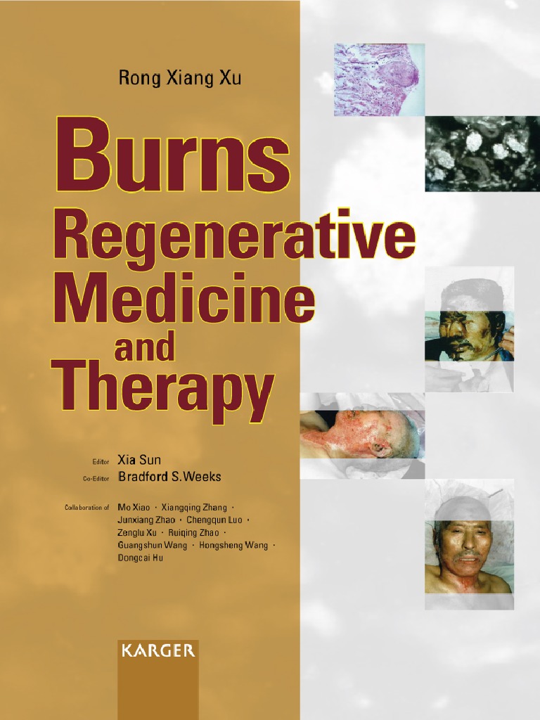 Burns Regenerative Medicine and Therapy 3HAXAP PDF | PDF | Burn | Cell ...