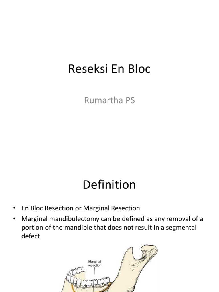 En Bloc Mandibulectomy: Definition, Indications, Complications ...