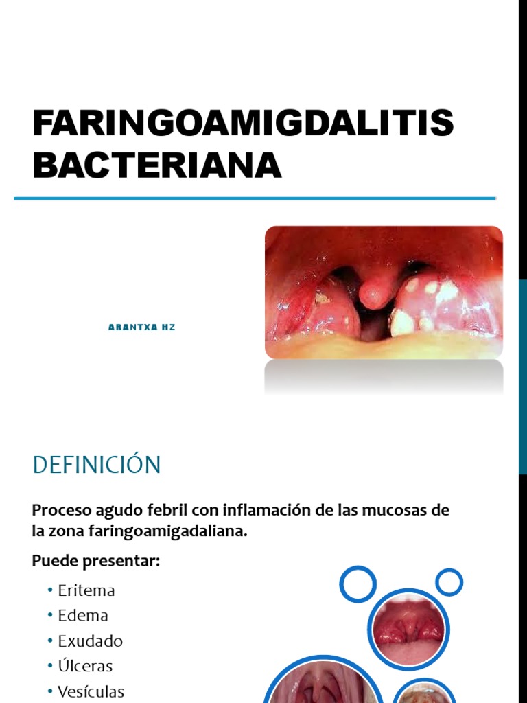Faringoamigdalitis | PDF | Penicilina | Estreptococo