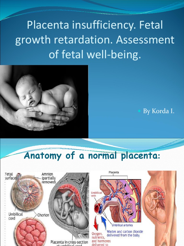 Assessing Fetal Well-Being: Evaluating Placental Function and Fetal ...