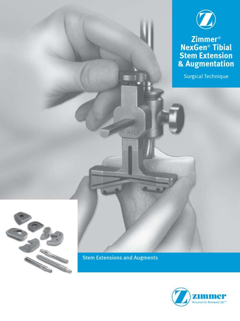 Zimmer Nexgen Tibial Stem Extension Augmentation Surgical Technique PDF ...