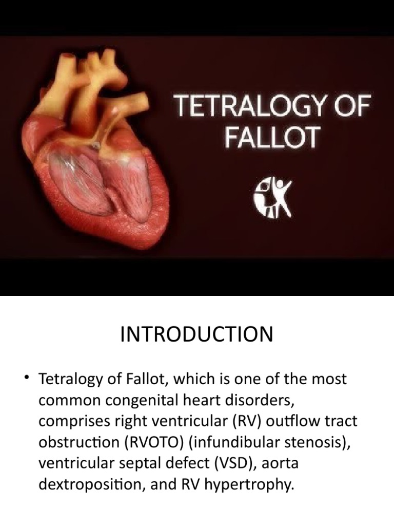 Tetralogy of Fallot | Download Free PDF | Congenital Heart Defect ...