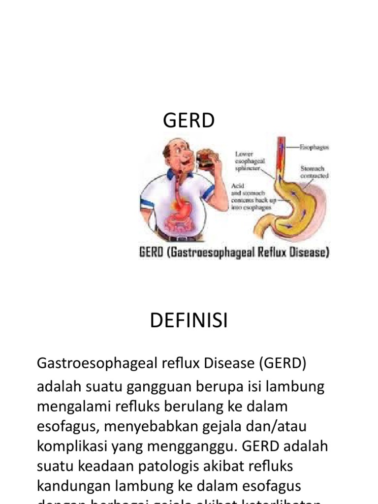Definisi dan Penanganan GERD | PDF | Kesehatan Holistik