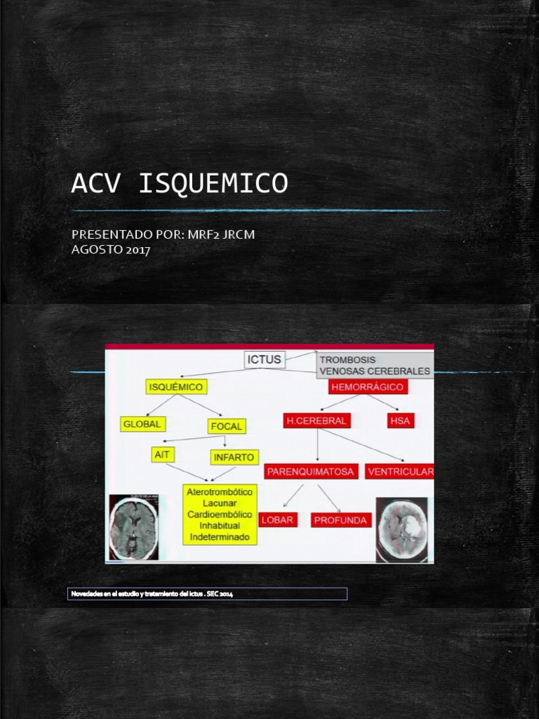 Acv Isquemico 2017 | PDF | Carrera | Especialidades Medicas