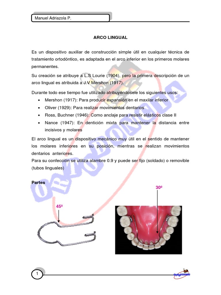 Arco Lingual | Ortodoncia | Boca