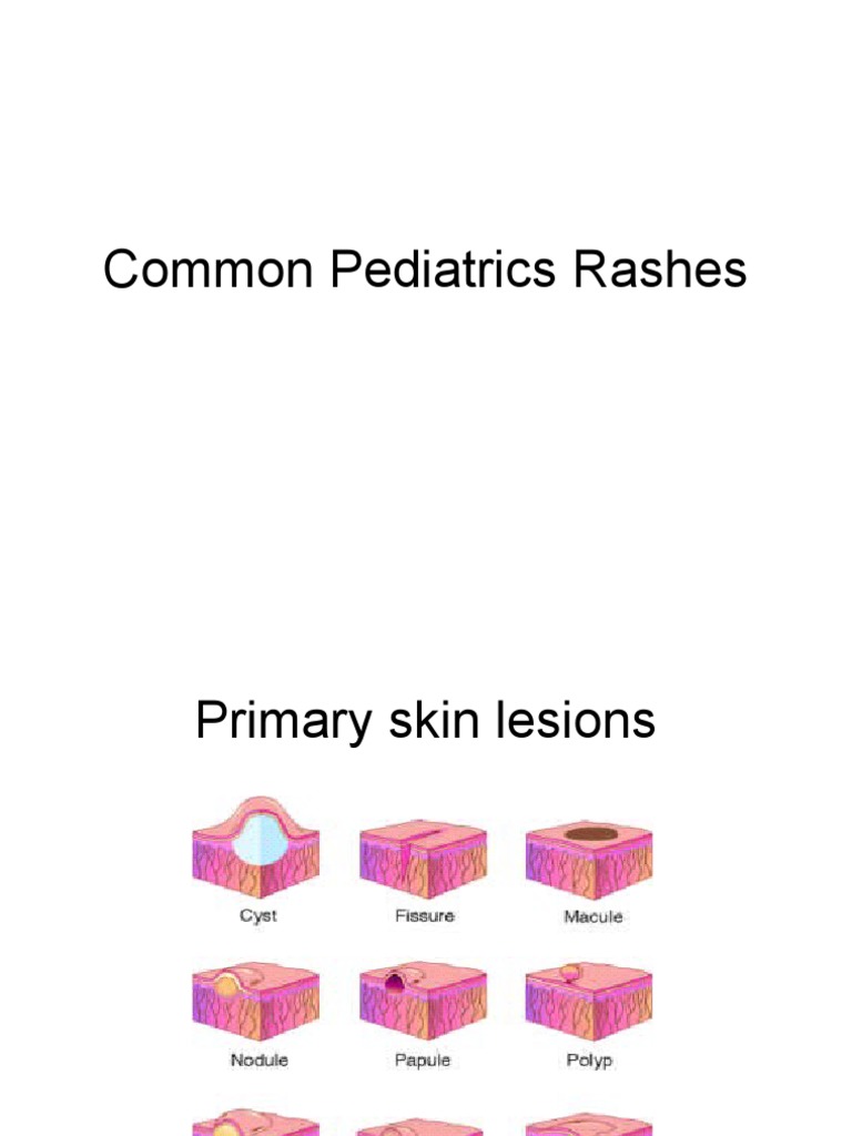 Rash Potpourri Didacticwith Animation | PDF | Topical Medication ...