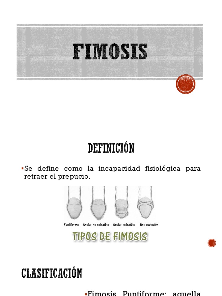 Fimosis | PDF