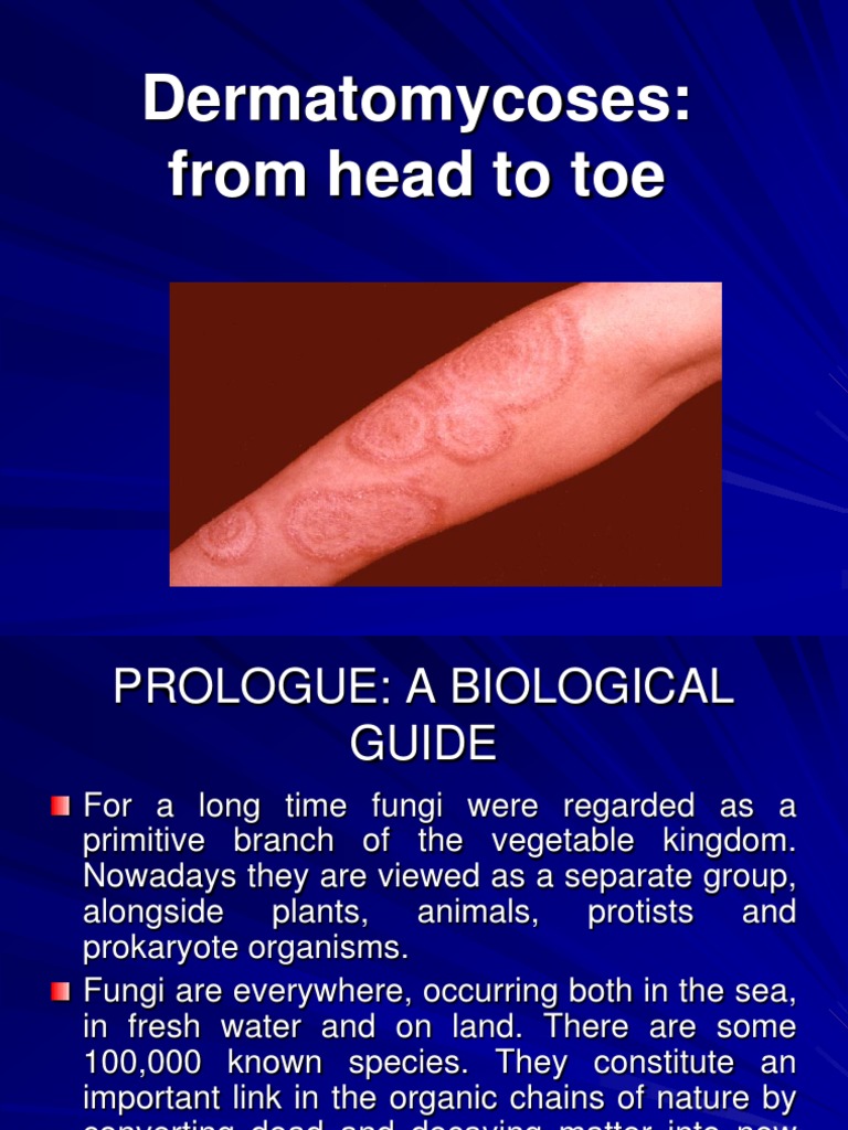 Dermatomycoses | PDF | Candidiasis | Candida (Fungus)