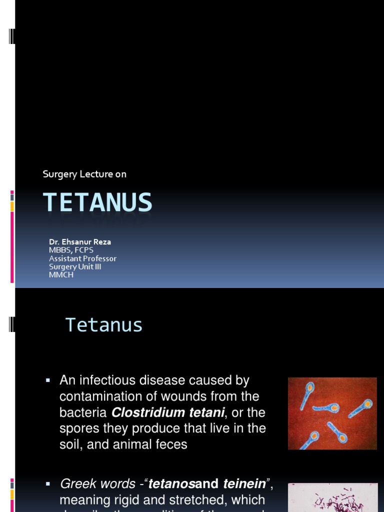 Tetanus | PDF | Medical Specialties | Clinical Medicine