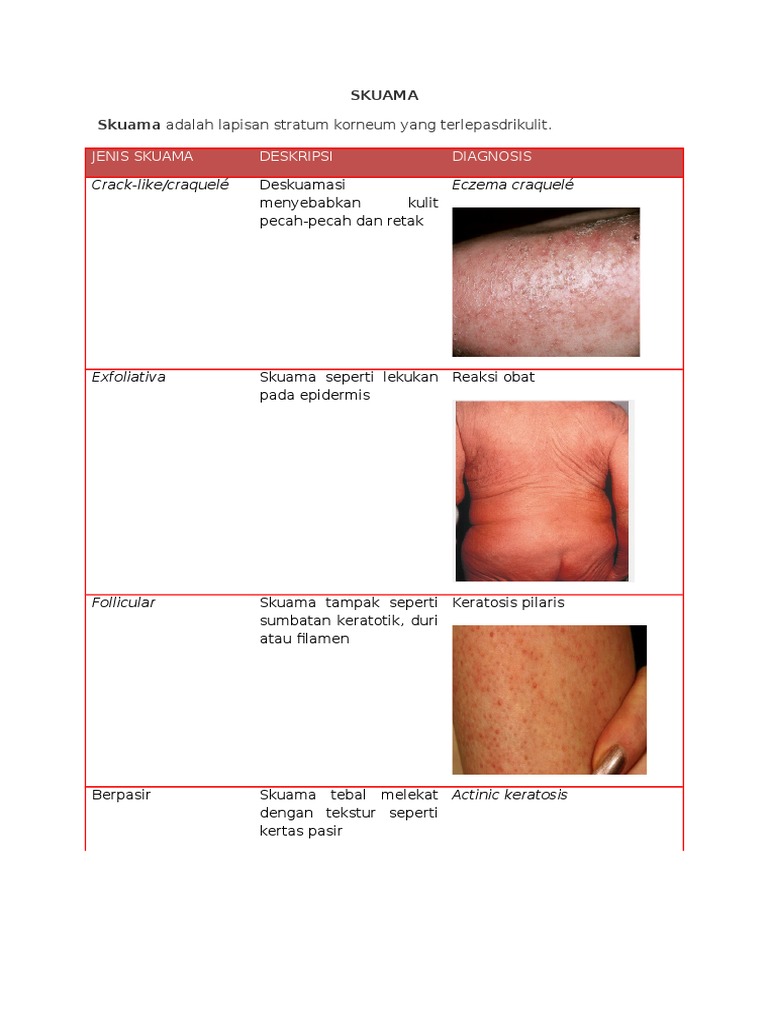 Jenis Skuama Dan Krusta | PDF