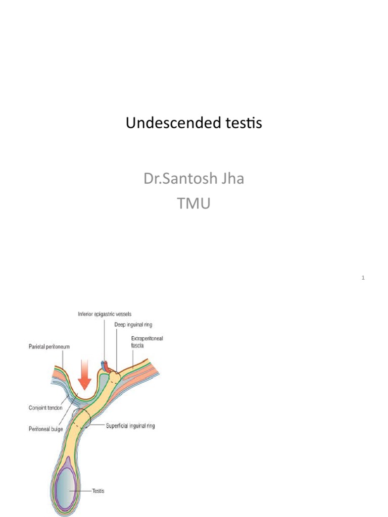 Urology 36 Undescended Testis | PDF | Testicle | Anatomy