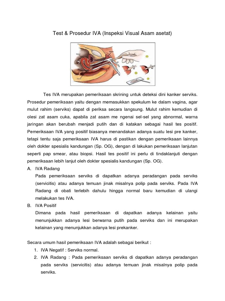 Test Dan Prosedur IVA | PDF