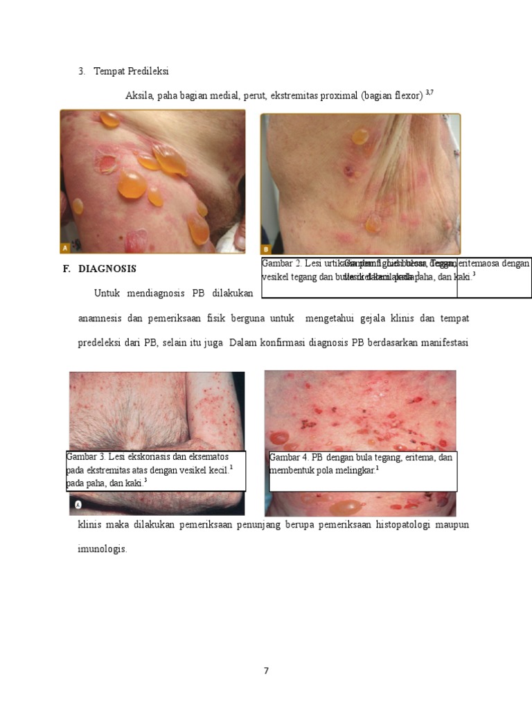 Tempat Predileksi | PDF