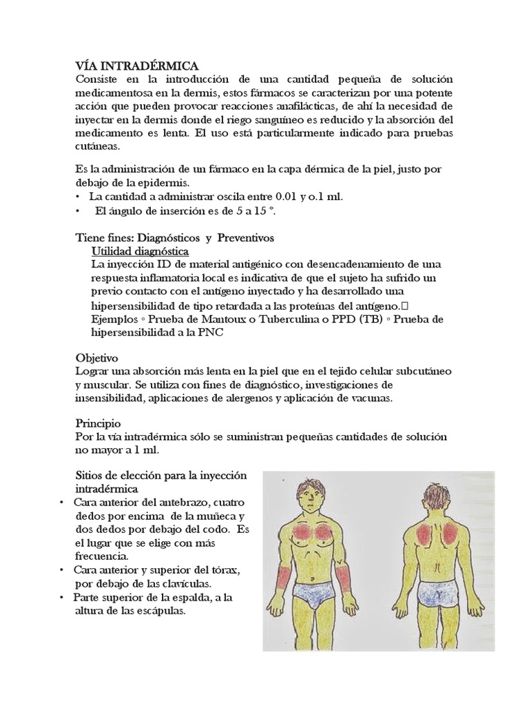 VÍA INTRADÉRMICA.docx | Inyección (medicina) | Medicamentos con receta ...