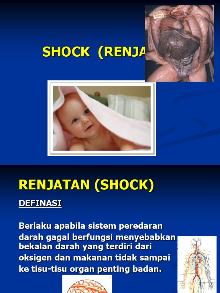 2 Renjatan | PDF