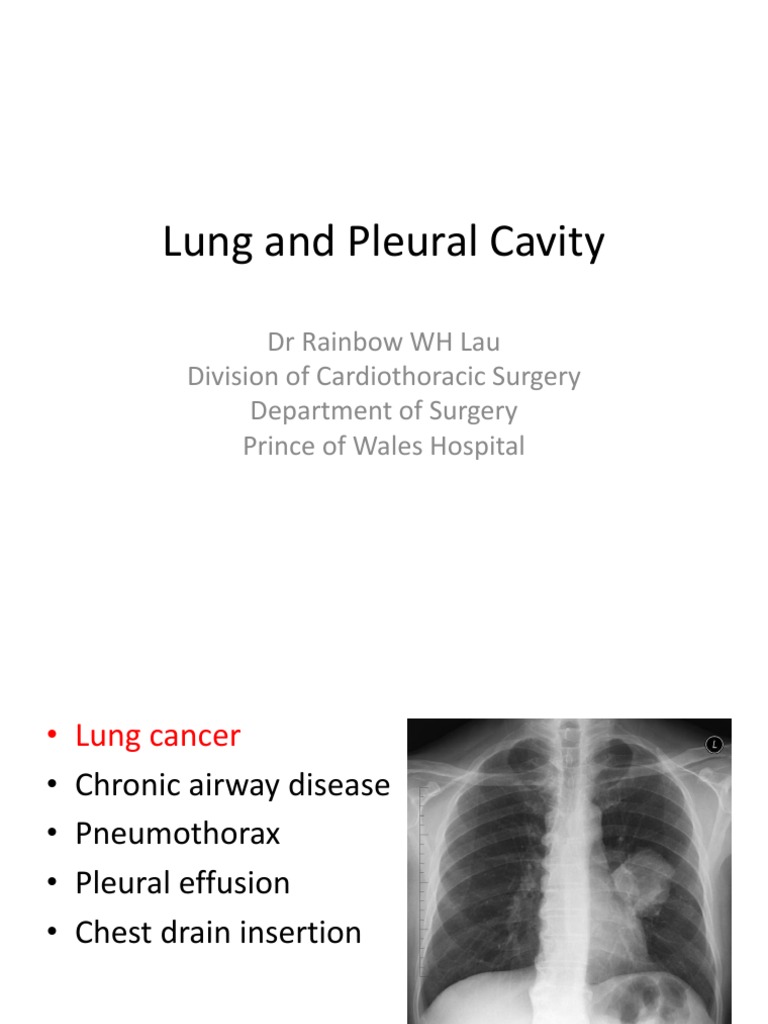 Introduction To Management of Pneumothorax, Chest Drains & Boxes | PDF ...