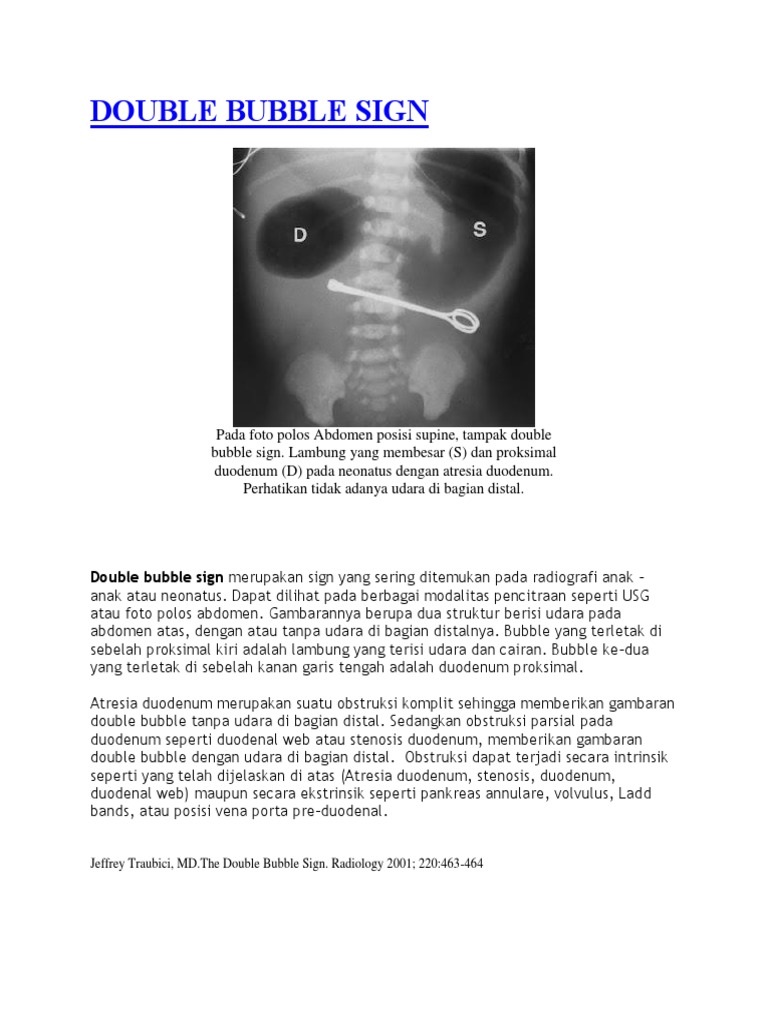 Double Bubble Sign | PDF