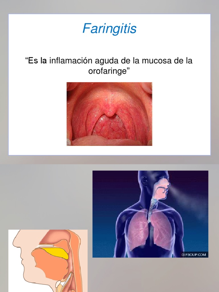 faringitis | Penicilina | Resfriado comun | Prueba gratuita de 30 días ...