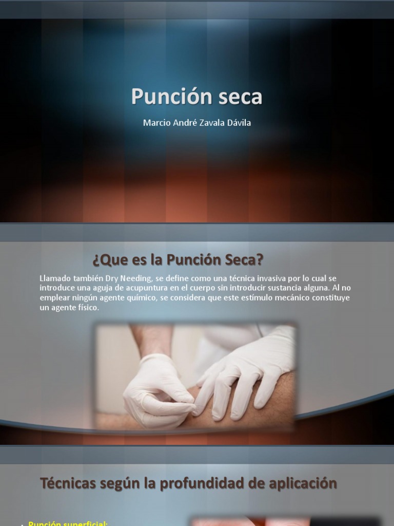 Punción Seca: Técnica y Aplicaciones | PDF