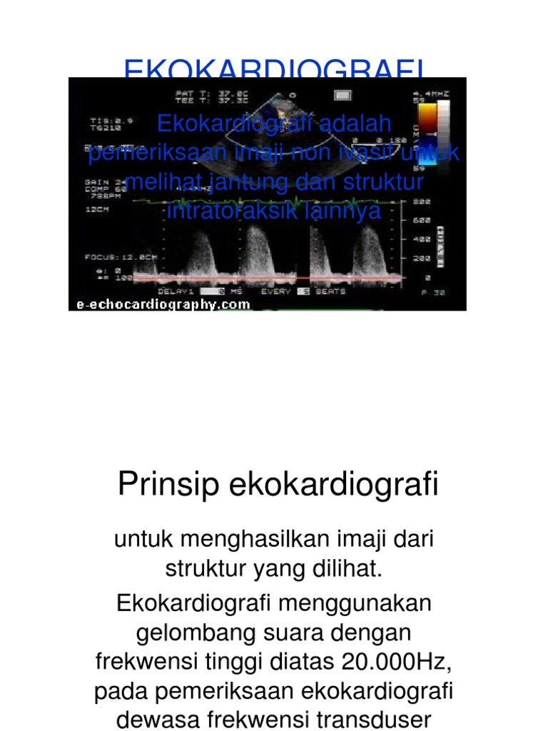 EKOKARDIOGRAFI | PDF
