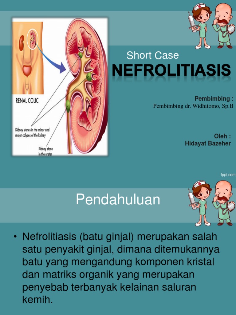 Nefrolitiasis | PDF