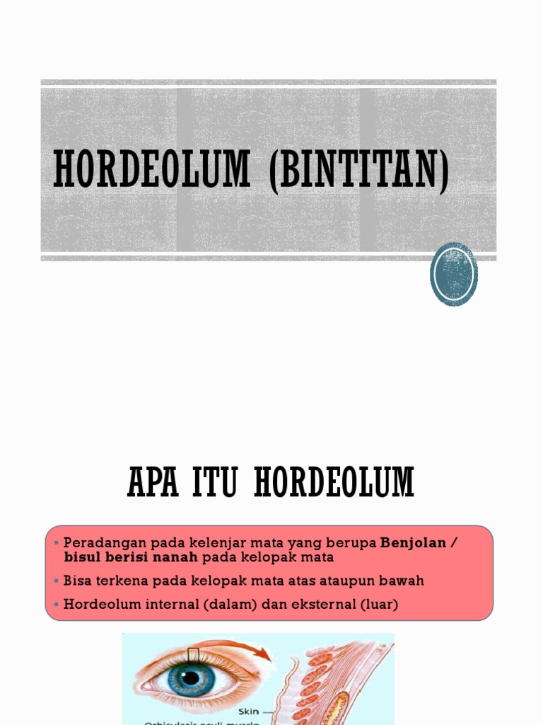 Penyuluhan Hordeolum | PDF