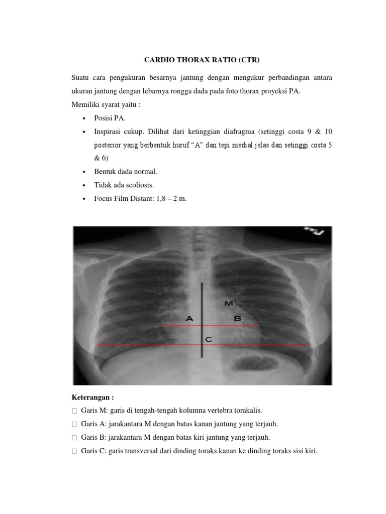 Cardio Thorax Ratio Ners Iccu | PDF