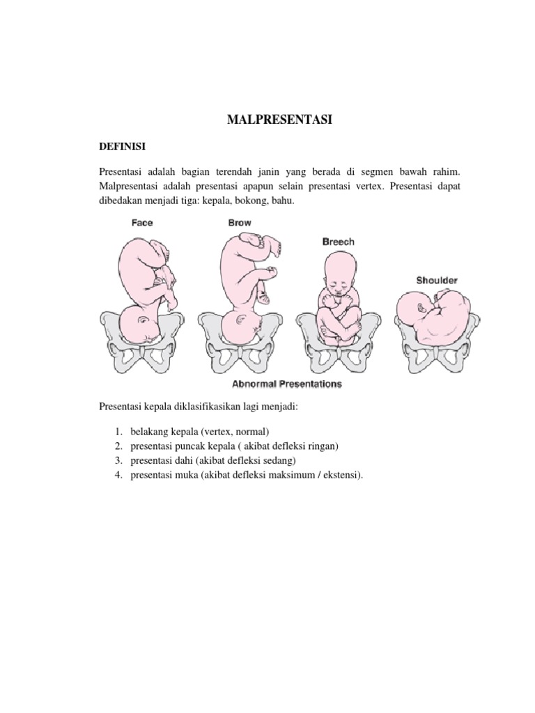 Malpresentasi Janin dalam Persalinan | PDF | Pengembangan Diri ...