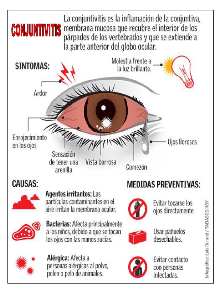 CONJUNTIVITIS