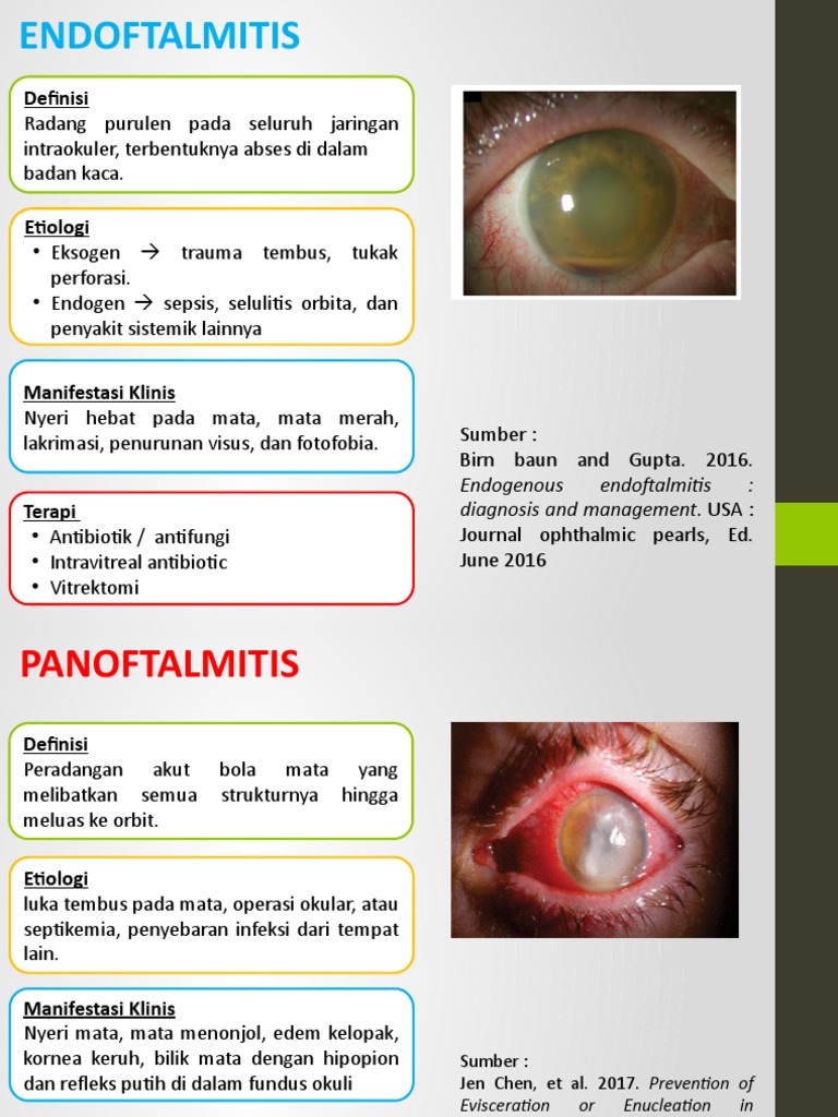 Endoftalmitis dan Panoftalmitis: Definisi, Etiologi, dan Terapi | PDF