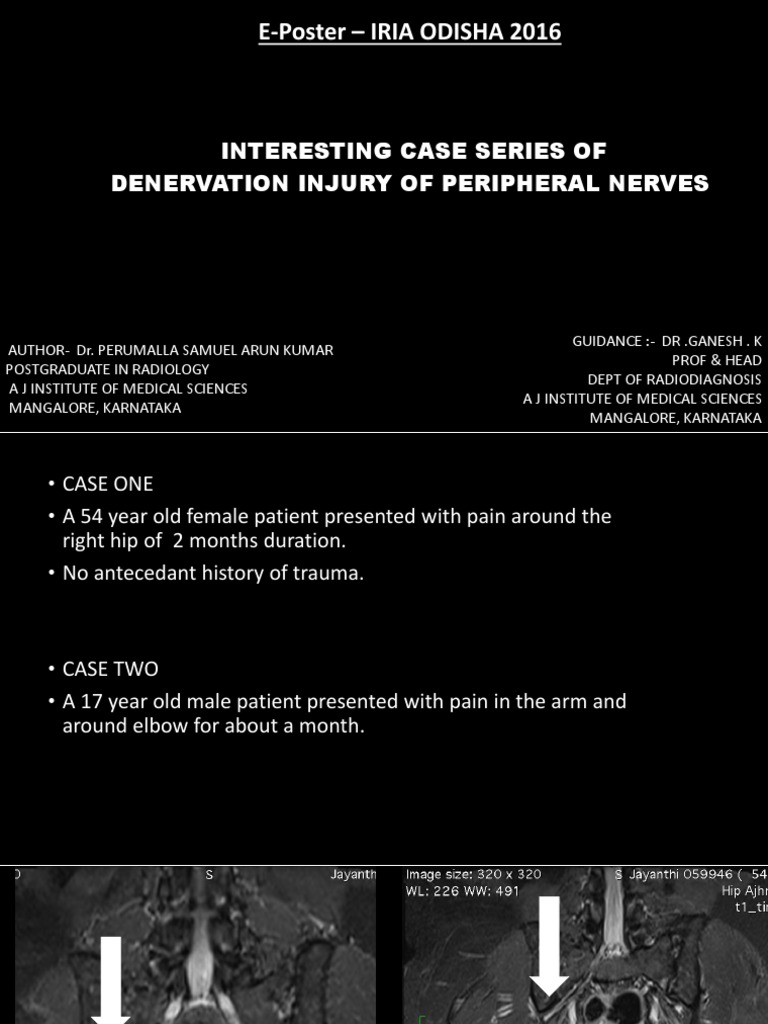 Mri Imaging of Peripheral Nerve Injury | PDF | Magnetic Resonance ...