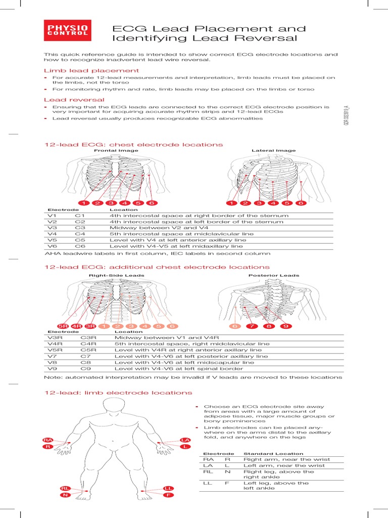 ECG Lead Placement and Lead Reversal Guide | PDF | Electrocardiography ...