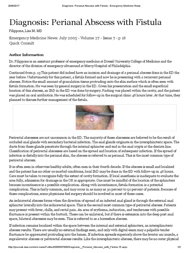 Diagnosis Perianal Abscess With Fistula Emergency Medicine News