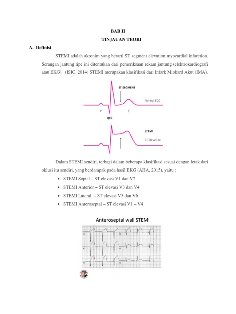 PENGKAJIAN TEORI TENTANG STEMI | PDF