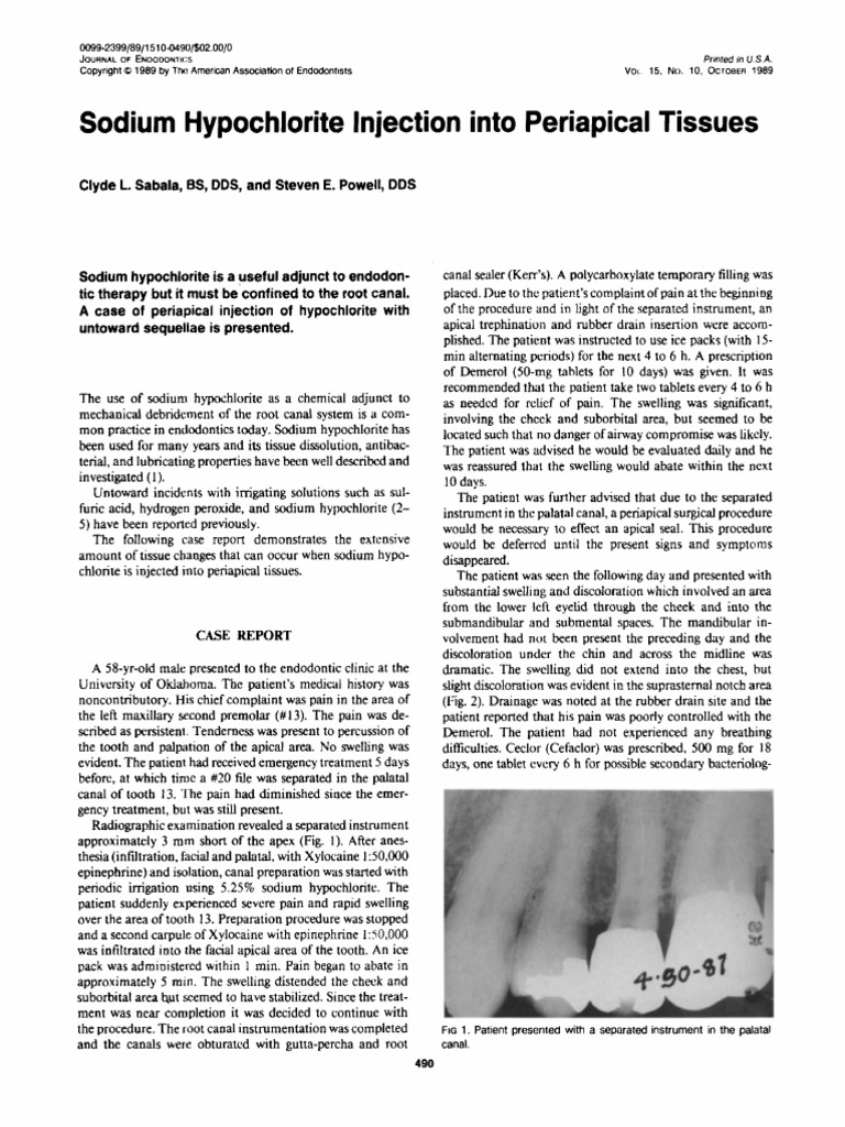 Sodium Hypochlorite Injection Into Periapical Tissues Sambala 1989 PDF ...