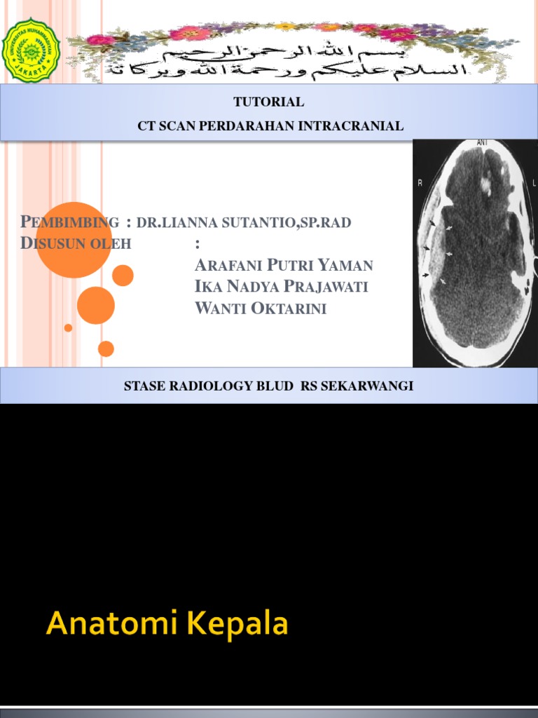 CT Scan untuk Perdarahan Intrakranial | PDF