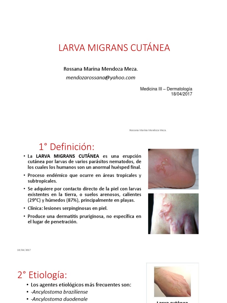 Larva Migrans Cutánea | PDF | Especialidades Medicas | Medicina CLINICA