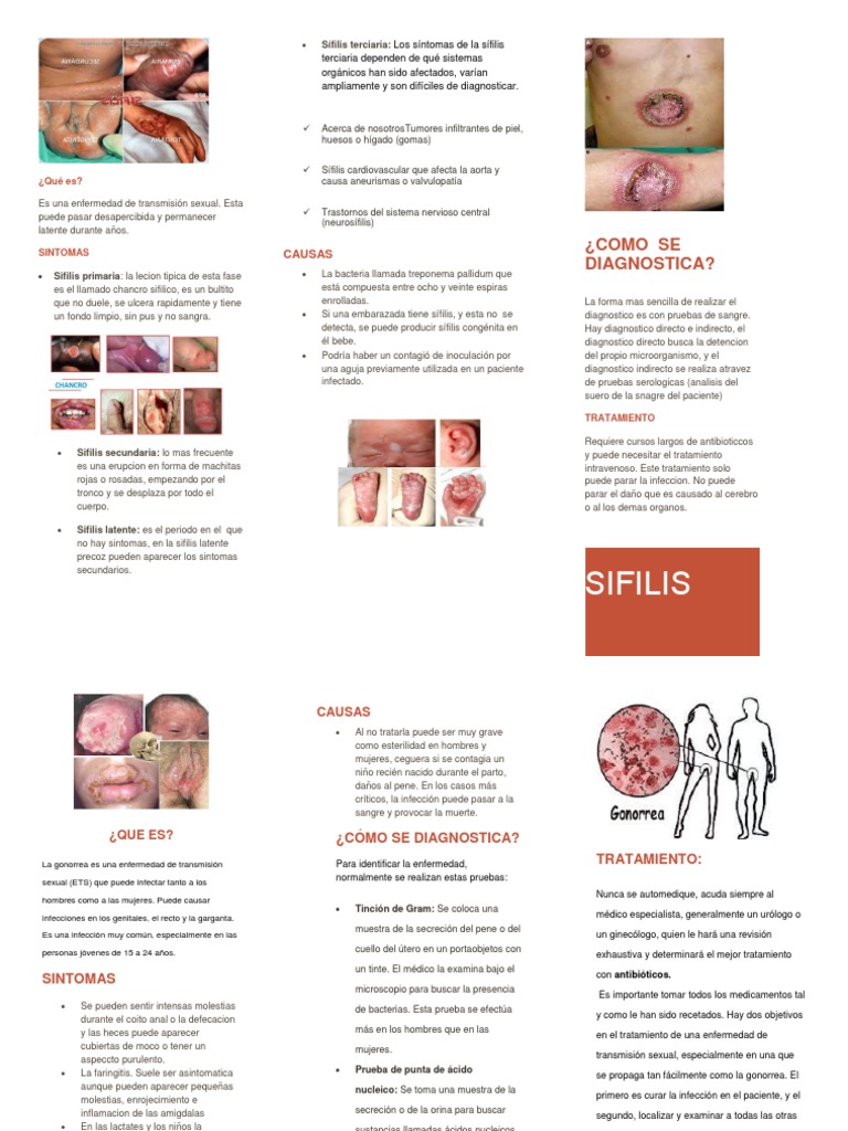 Folleto Sifilis | PDF | Infección transmitida sexualmente | Salud pública