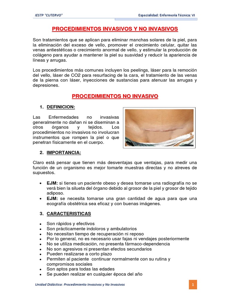 Procedimientos Invasivos y No Invasivos | PDF | Cirugía ...