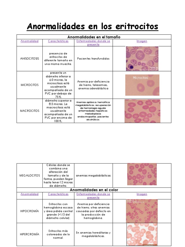 Anormalidades en Los Eritrocitos | Glóbulo rojo | Anemia