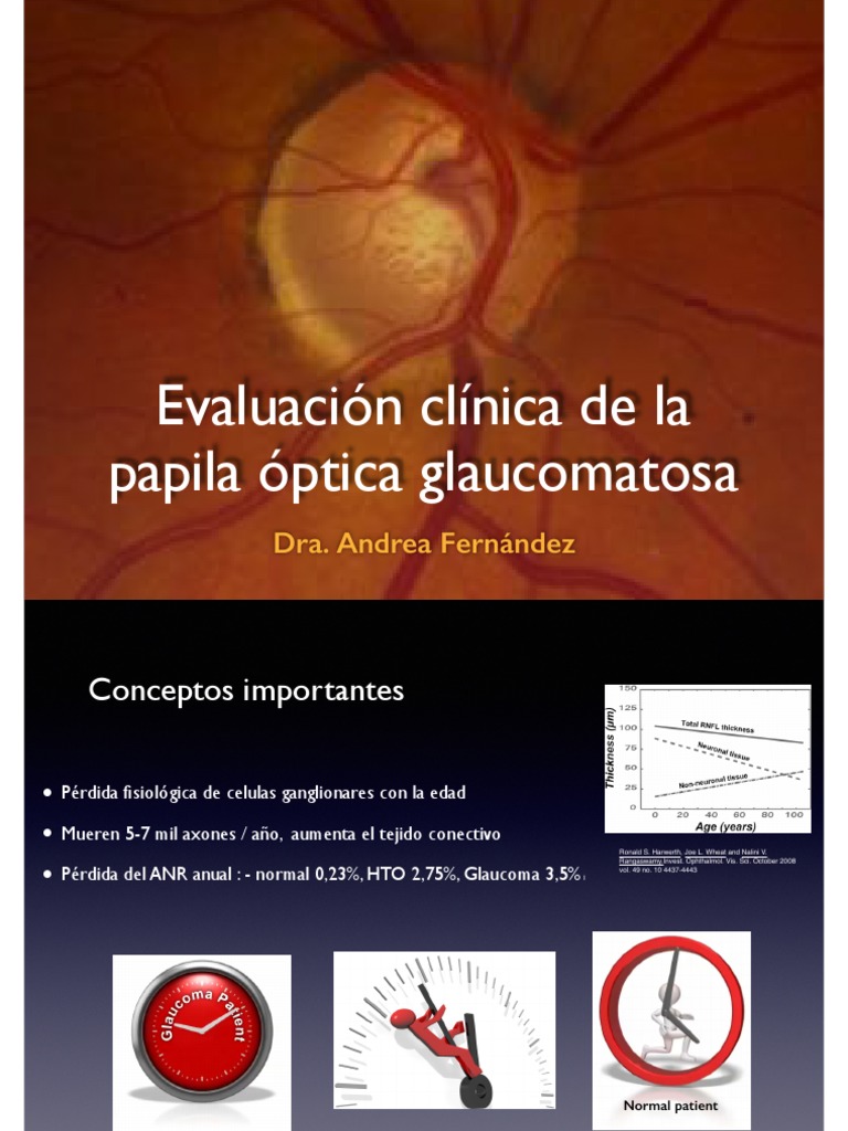 Evaluacion Papila Optica | PDF | Glaucoma | Visión