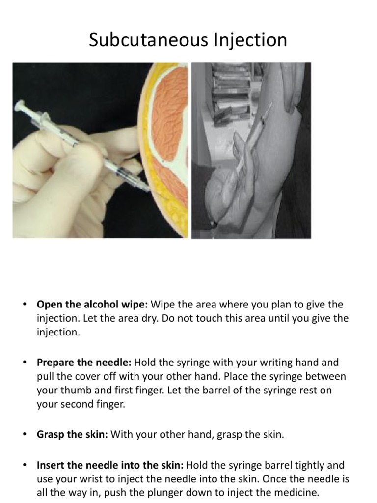 How to Administer Subcutaneous Injections | PDF