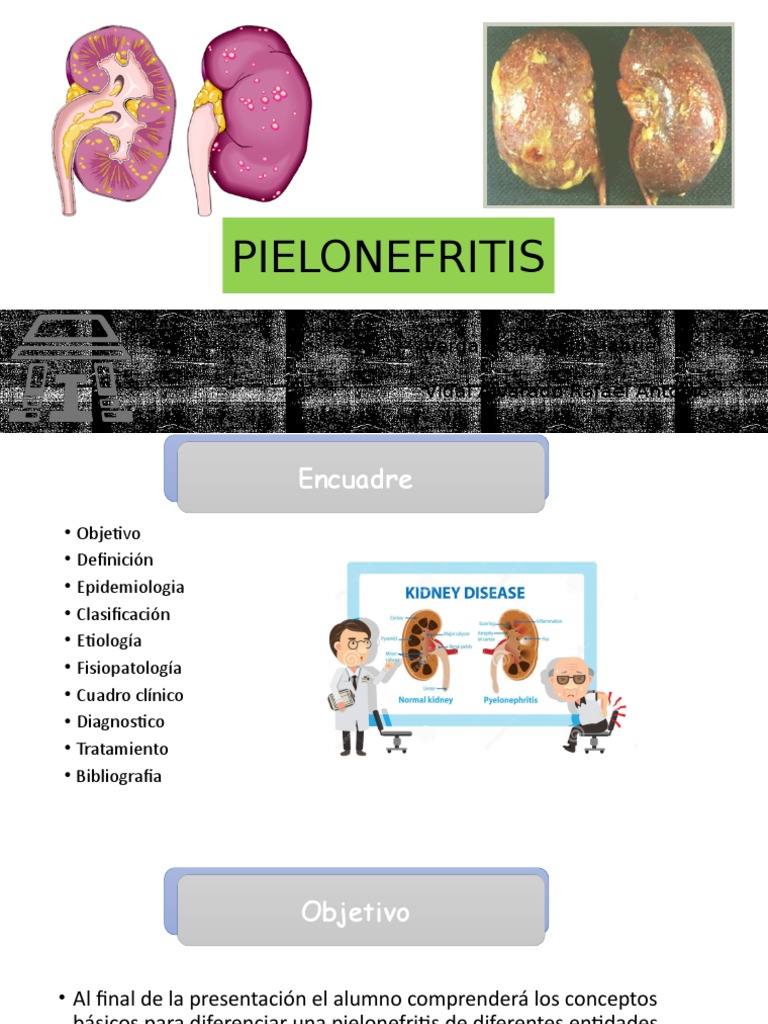 PIELONEFRITIS | Septicemia | Enfermedades y trastornos | Prueba ...