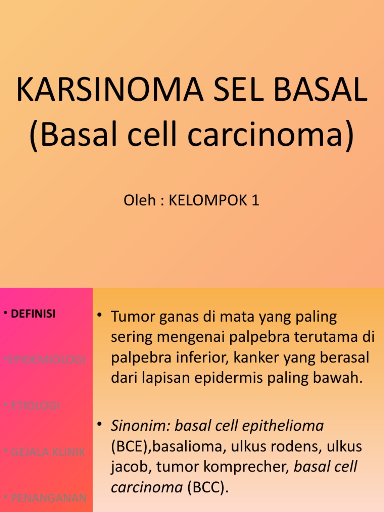 Karsinoma Sel Basal | PDF