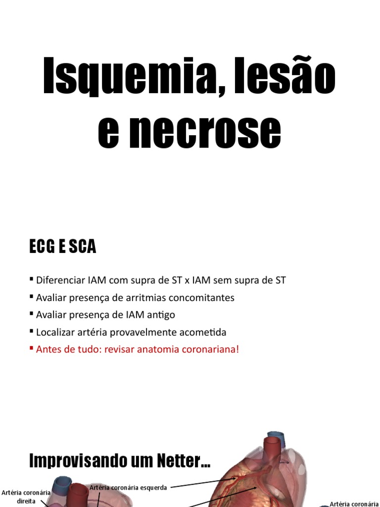 ECG Isquemia, Lesão e Necrose | PDF | Circulação coronária ...